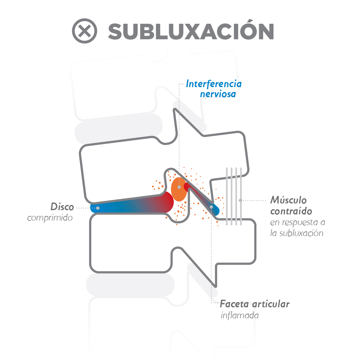 Que hago – Quiropráctico Santos